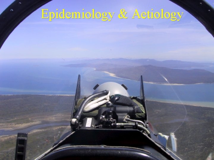 Diverticular Disease Richard Rahdon Objectives Definition Pathology ...