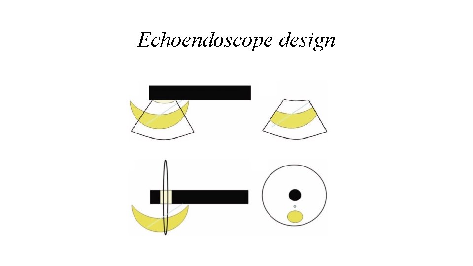 Endosonography Tarek Almouradi MD Introduction Diagnostic ...