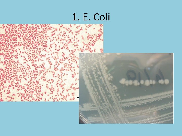 Bacterial Identification 1 E Coli Gram negative rods