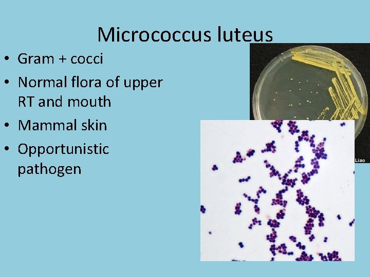 Bacterial Identification 1 E Coli Gram negative rods