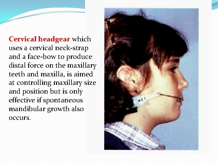 Functional appliance Dr Hoori Mir Mohammad Sadeghi Class