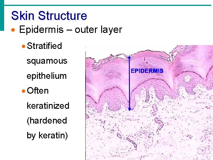 Chapter 4 Skin and Body Membranes Slides 4