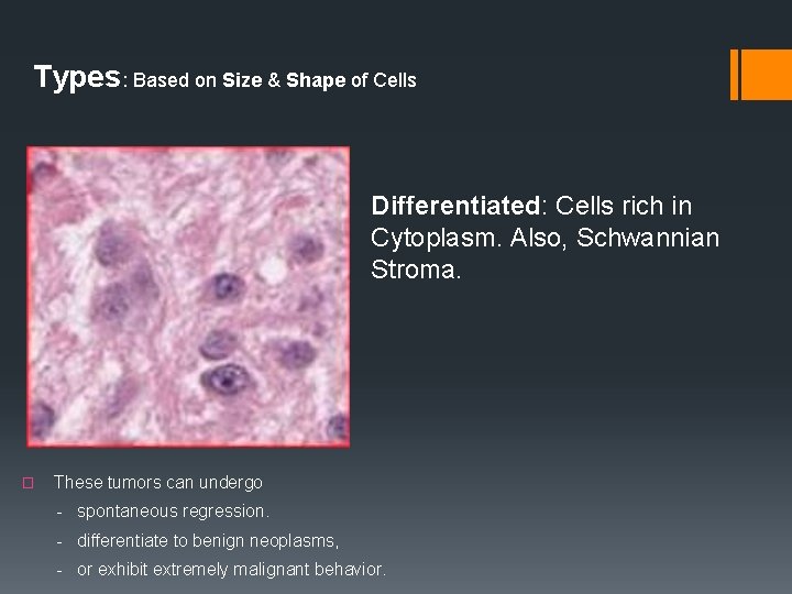 Neuroblastoma Supervised by Dr Ibrahim Sbou Done by