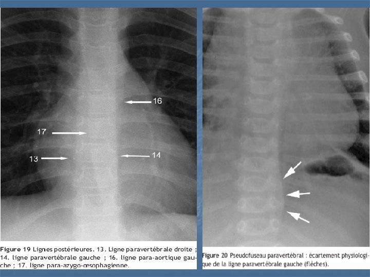 Radioanatomie du thorax Introduction n n La connaissance