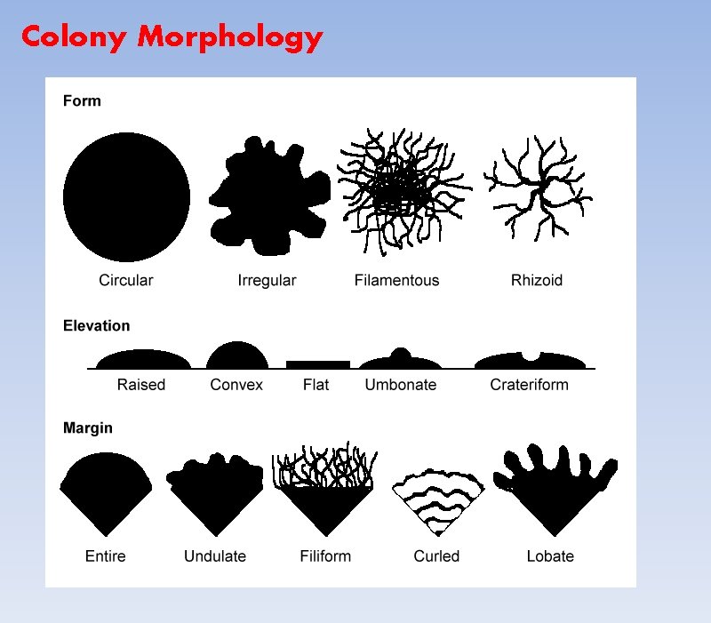 How to look at bacteria Gram Staining There