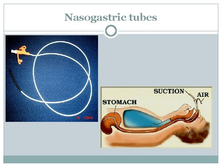 Casts Drains and Dressings Fracture management stabilization devices