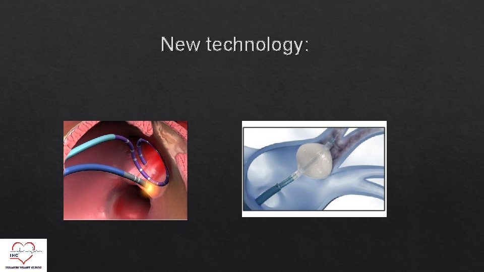 Contemporary Atrial Fibrillation Management Morhaf Ibrahim MD FHRS
