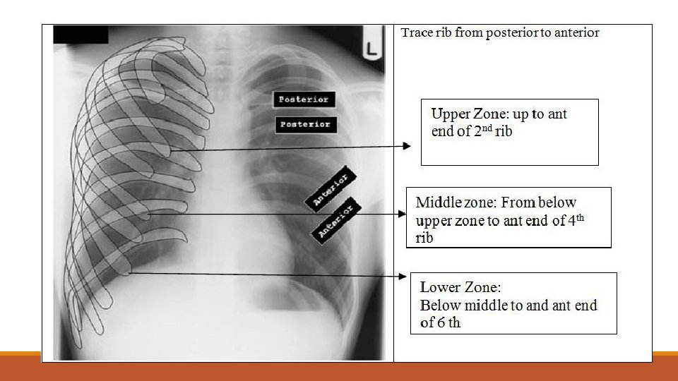 Intro to Radiology Definitions X ray 1 an