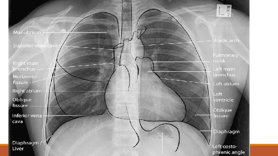 Intro to Radiology Definitions X ray 1 an