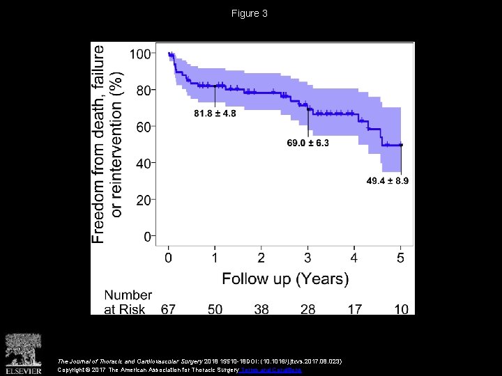 Open descending thoracic or thoracoabdominal aortic approaches for