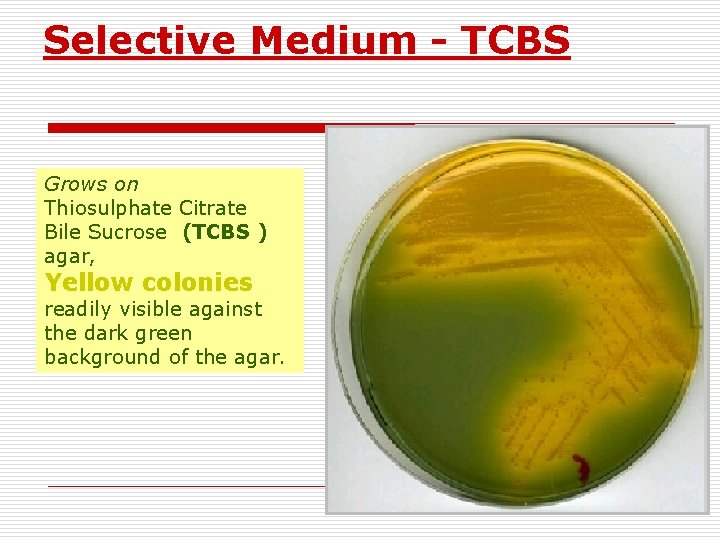 ODESSA NATIONAL MEDICAL UNIVERSITY Microbiology virology and immunology