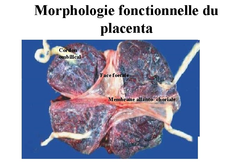 LE PLACENTA Le placenta humain se prsente comme