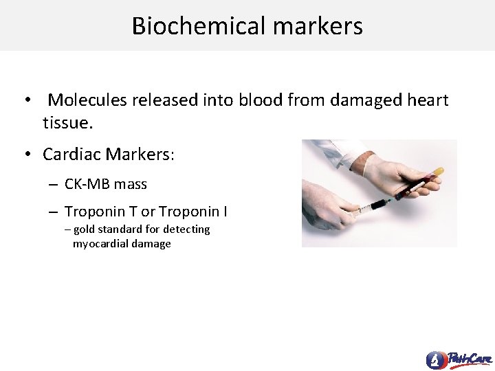Myocardial Infarction Blood tests for diagnosis Dr Esm