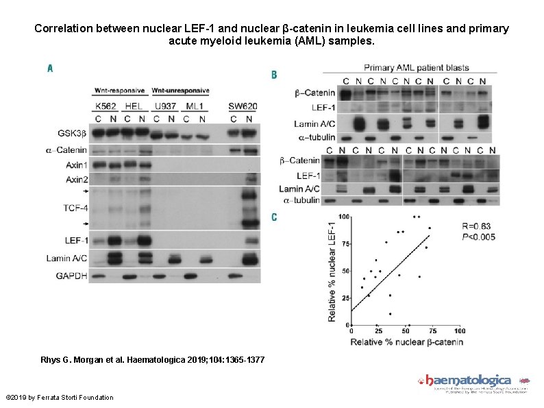 LEF1 drives aberrant catenin nuclear localization in myeloid