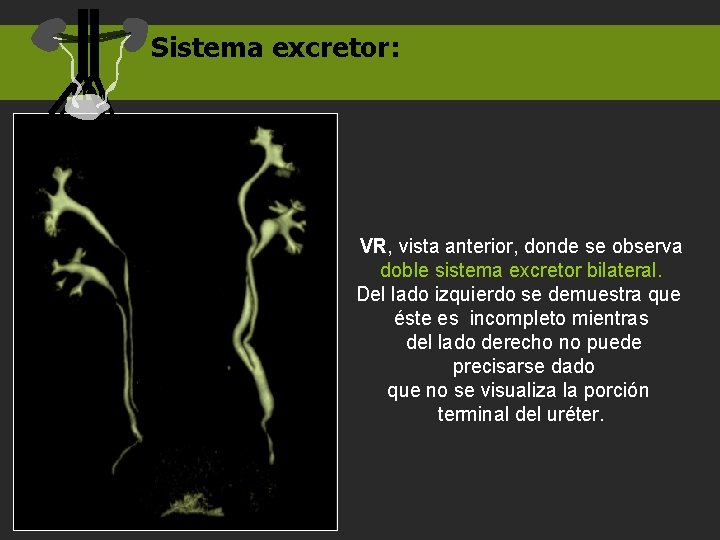 Sistema excretor Qu necesita saber el cirujano Presencia