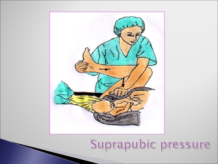 Shoulder dystocia Abdulkareem Fayoumi OBJECTIVES Definition Incidence ...