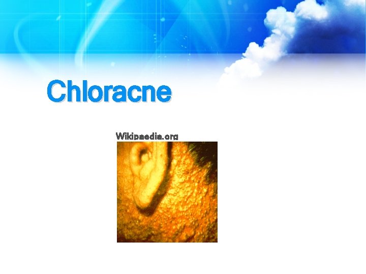 Environmental pollutants Domina Petric MD Polychlorinated biphenyls PCBs