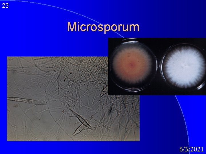 1 Medical Mycology Superficial Cutaneous and Subcutaneous Mycoses
