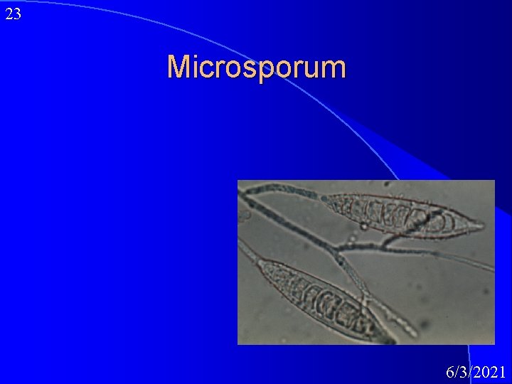 1 Medical Mycology Superficial Cutaneous and Subcutaneous Mycoses