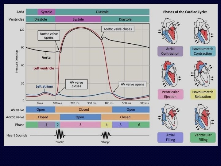 IABP Intraaortic balloon pump counterpulsation Acute circulatory support
