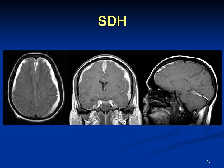 Radiology of common brain diseases 366 RAD 1