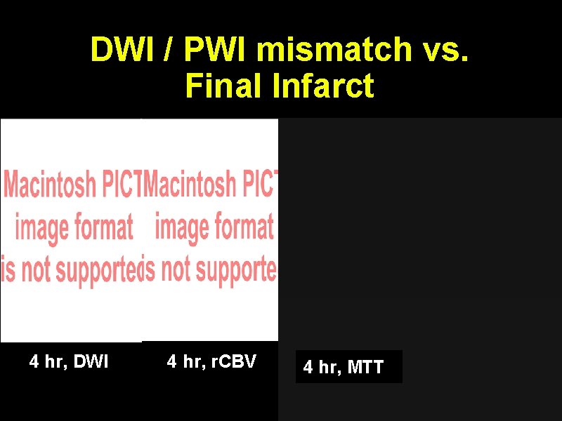 Cerebral MR Perfusion Imaging 2006 A G Sorensen