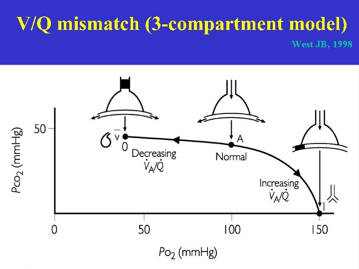 Pulmonary embolism pulmonary hypertension cor pulmonale chronicum Attila