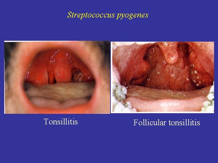 Streptococci Lecture 5 Medical Microbiology SBM 2044 Streptococcus