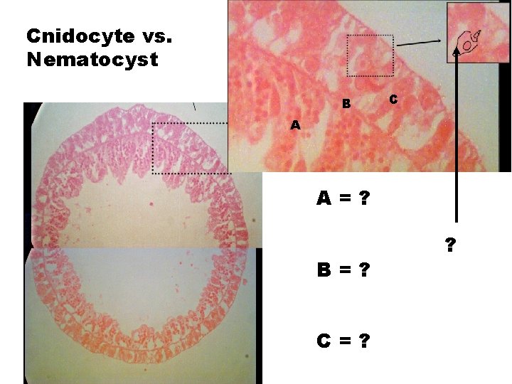 PHYLUM CNIDARIA TISSUE level of body organization Middle
