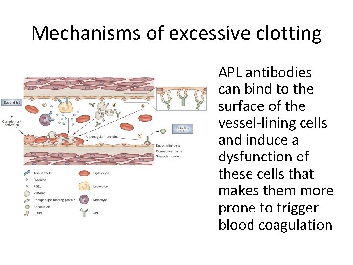 Mechanisms of disease in the antiphospholipid syndrome by