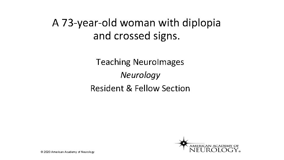 A 73 yearold woman with diplopia and crossed
