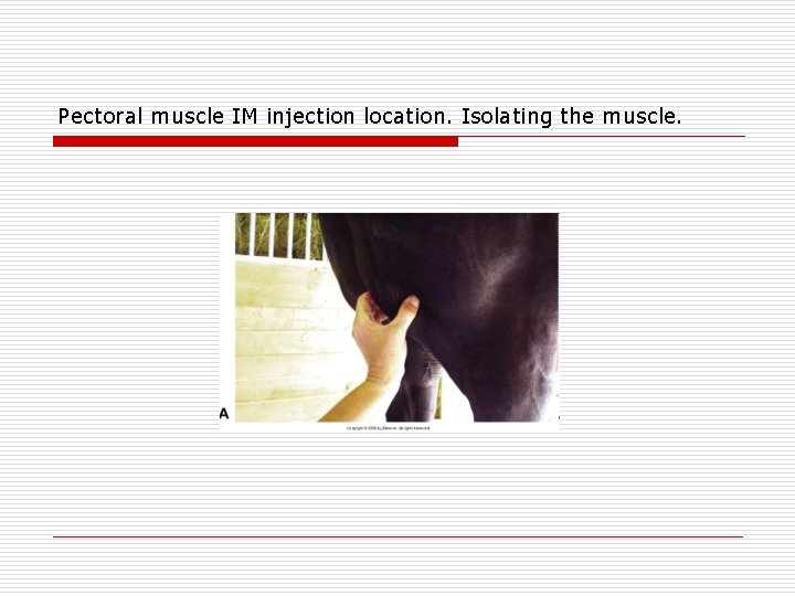 Pectoral muscle IM injection location Isolating the muscle