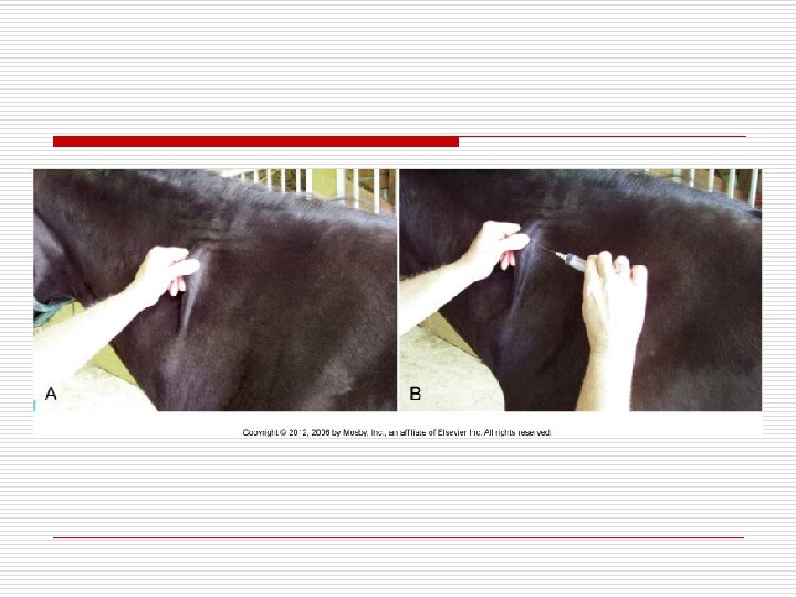 Pectoral muscle IM injection location Isolating the muscle