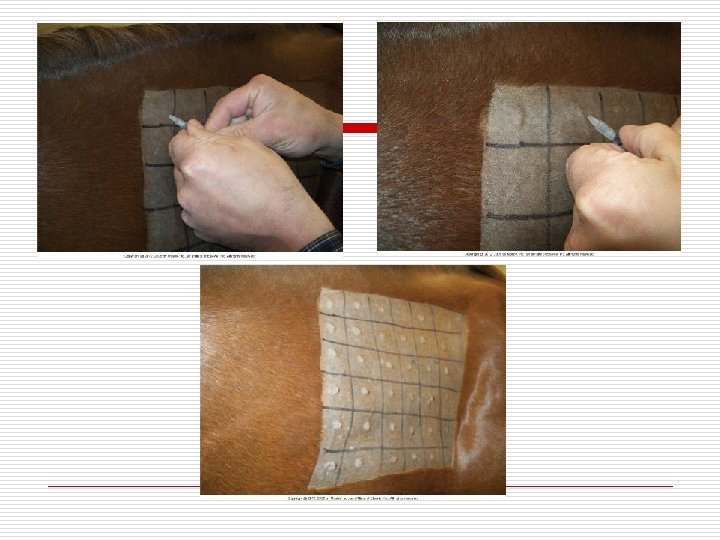 Pectoral muscle IM injection location Isolating the muscle