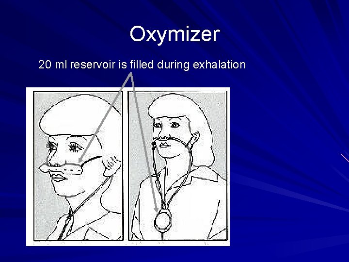 Skills Days Winter 2007 Competency ReviewDiscussion Bi PAP