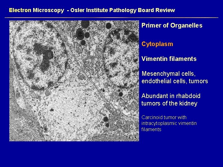 Electron Microscopy Osler Institute Pathology Board Review Primer