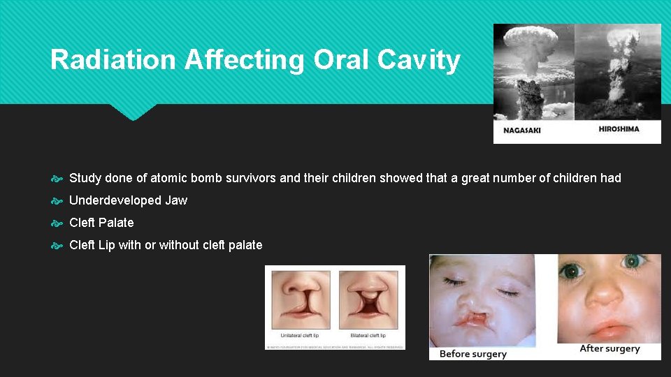 Radiation Effects Jenan AlKeswani Professor Maria Bilello What