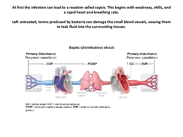 SIRS Sepsis and septic shock By Leen Alawneh