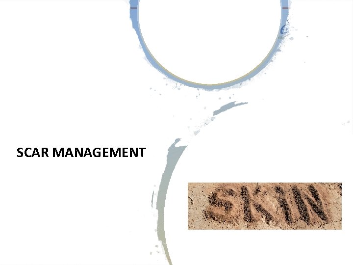 SCAR MANAGEMENT How do scars form Natural reaction