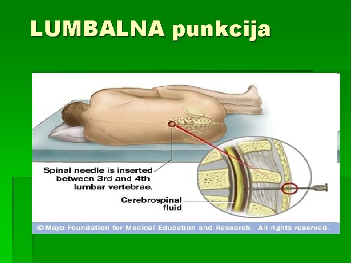 VIRI IN POTA IRJENJA OKUB ZNAILNOSTI INFEKCIJSKIH BOLEZNI