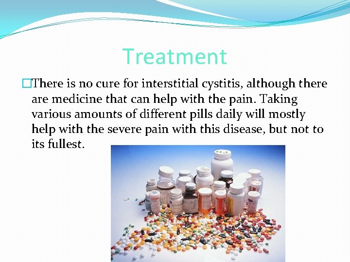 Interstitial Cystitis Painful Bladder Syndrom By Katherine Daschke