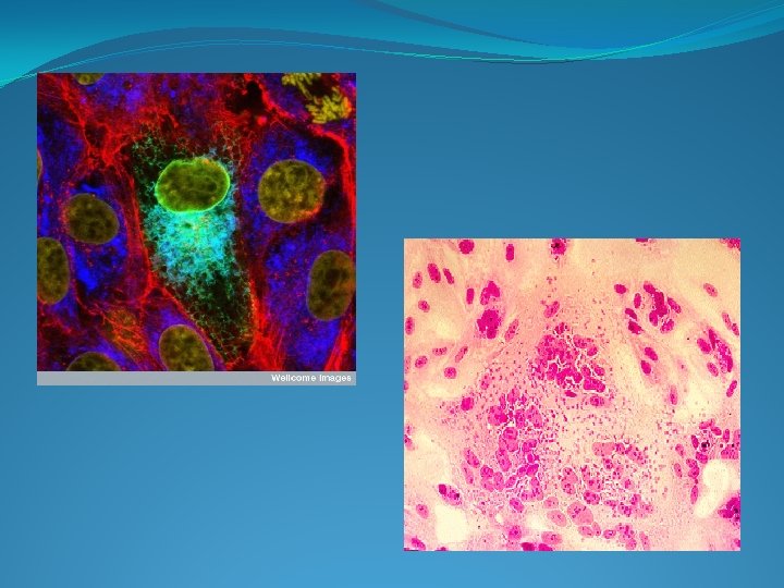 INFECTIA URLIANA OREIONUL boal infecioas viral acut generalizat