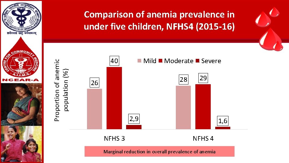 Anemia Mukt Bharat Webinar Series Pediatric Anemia in