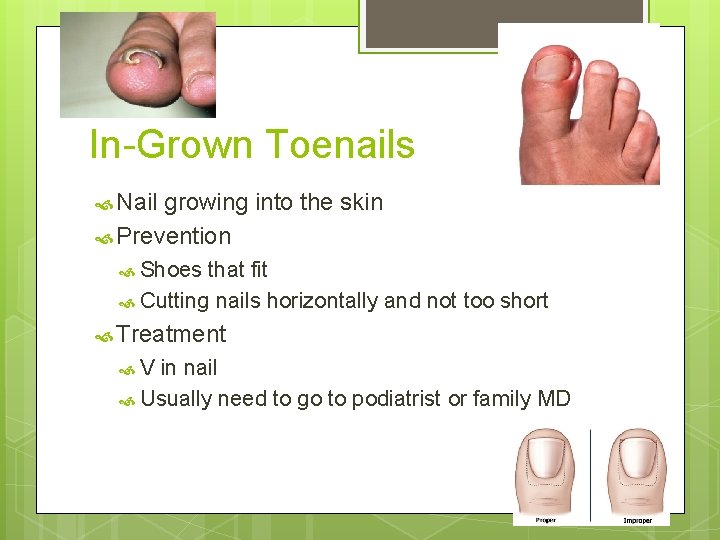 Foot and Ankle Injuries Blisters friction causing fluid