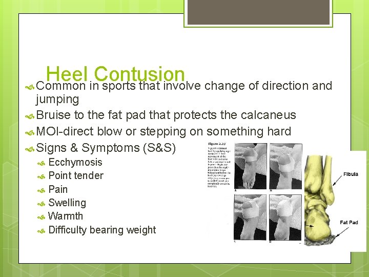 Foot and Ankle Injuries Blisters friction causing fluid