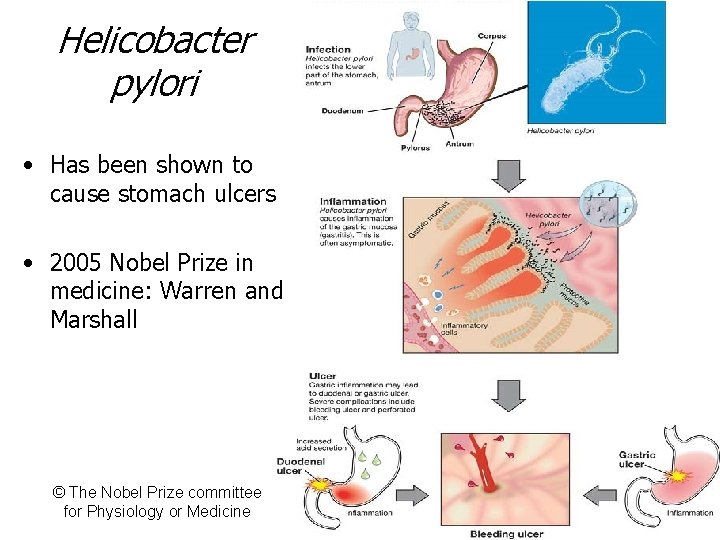 Breath Analysis by Cavity Ring Down Spectroscopy Joseph