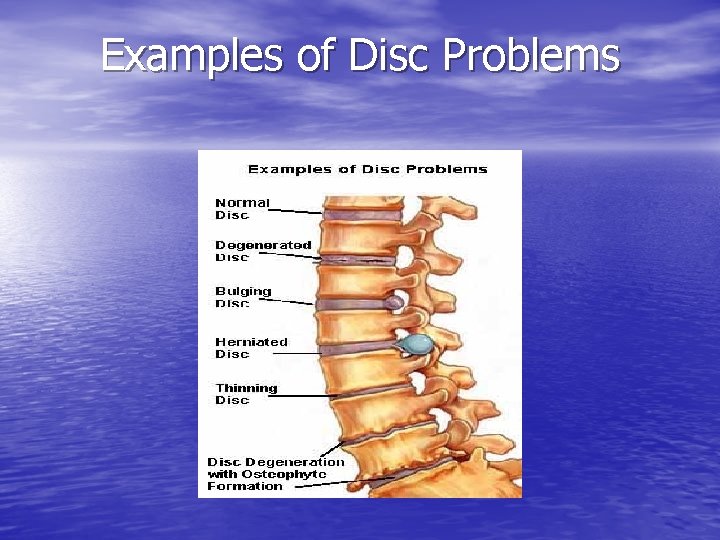 The Treatment of Arthritis Back Pain With Chinese