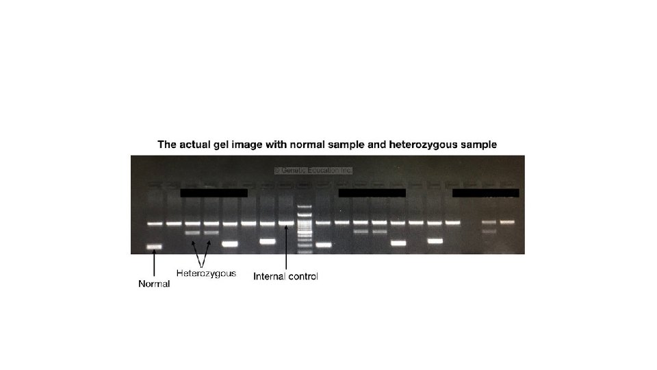 ARMSPCR Amplification Refractory Mutation System PCR Ali I