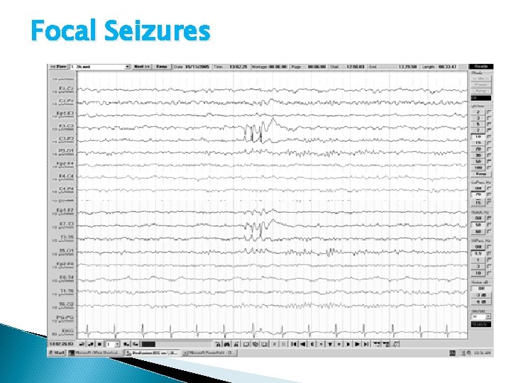 Management of Epilepsy Dr Aminur Rahman FCPSMed MDNeuro