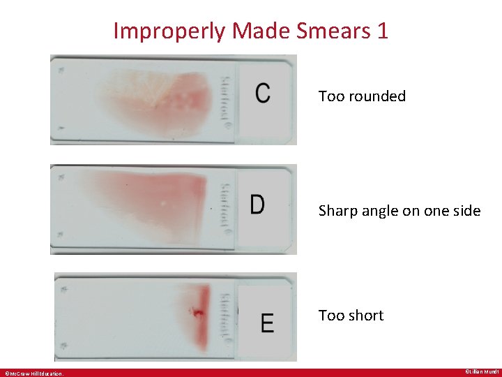 Special Phlebotomy Procedures Chapter 13 Mc GrawHill Education